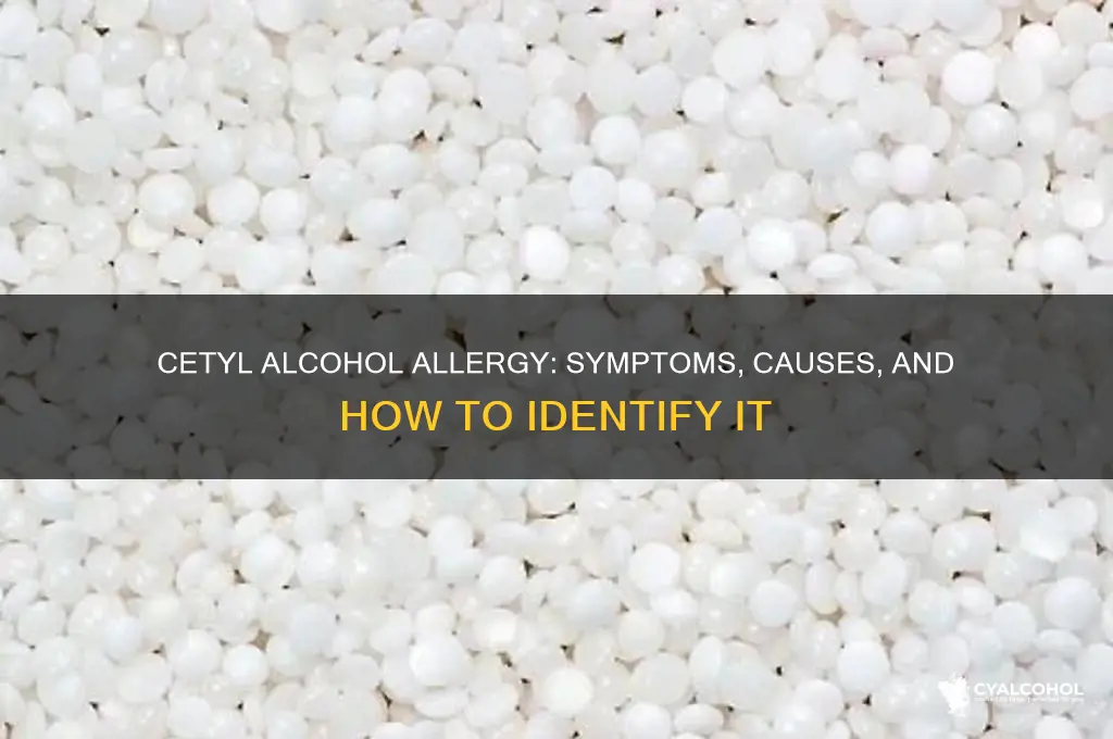 Cetyl Alcohol Allergy: Symptoms, Causes, And How To Identify It | CyAlcohol