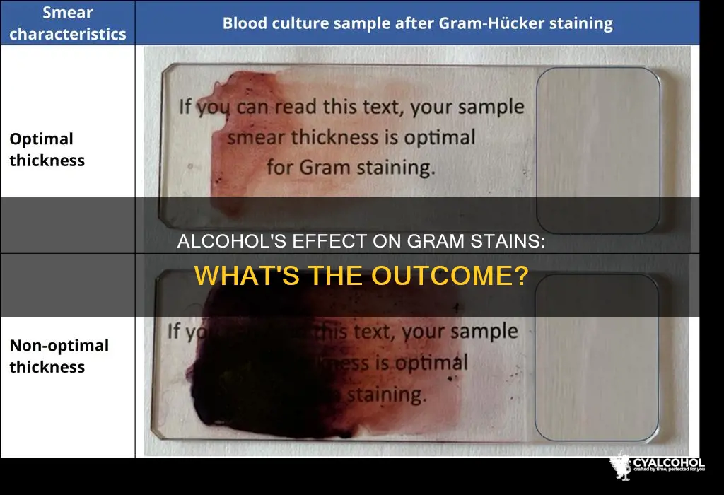 Alcohol's Effect On Gram Stains: What's The Outcome? | CyAlcohol