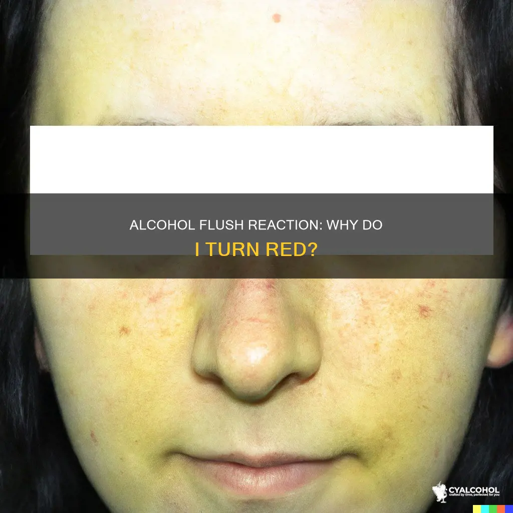 Alcohol Flush Reaction: Why Do I Turn Red? | CyAlcohol
