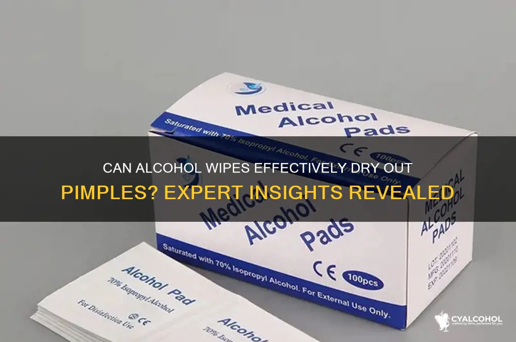 Can Alcohol Wipes Effectively Dry Out Pimples? Expert Insights Revealed ...