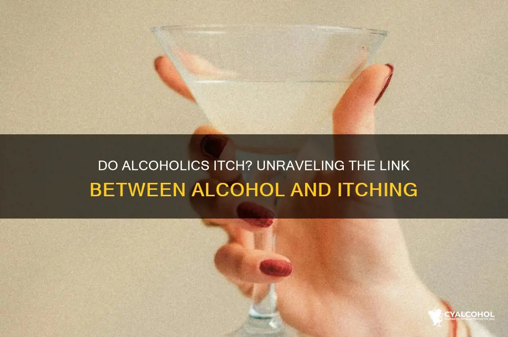 Do Alcoholics Itch? Unraveling The Link Between Alcohol And Itching ...