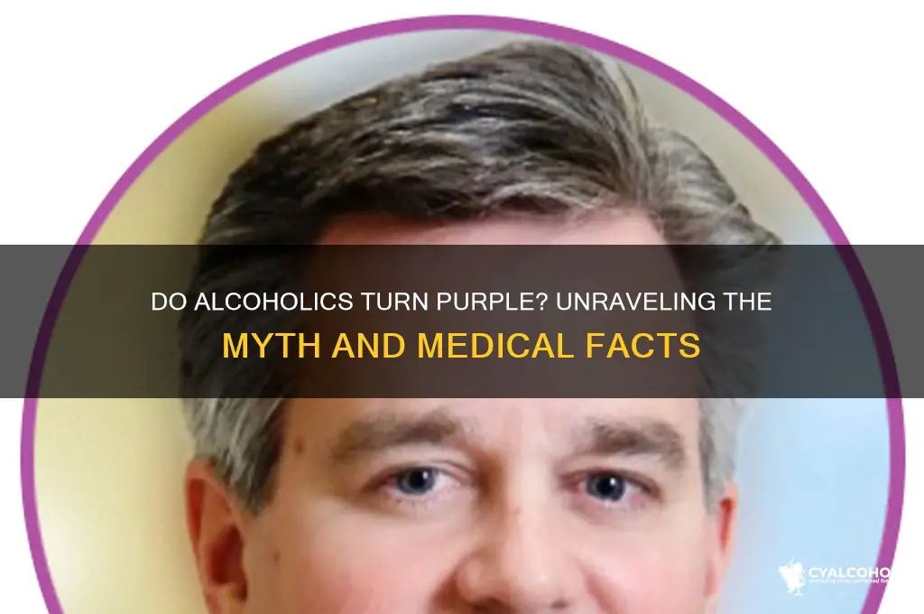 Do Alcoholics Turn Purple? Unraveling The Myth And Medical Facts ...