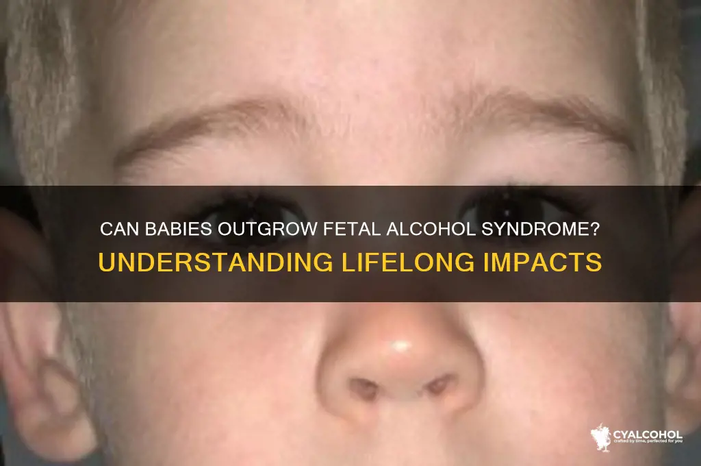 Can Babies Outgrow Fetal Alcohol Syndrome? Understanding Lifelong ...