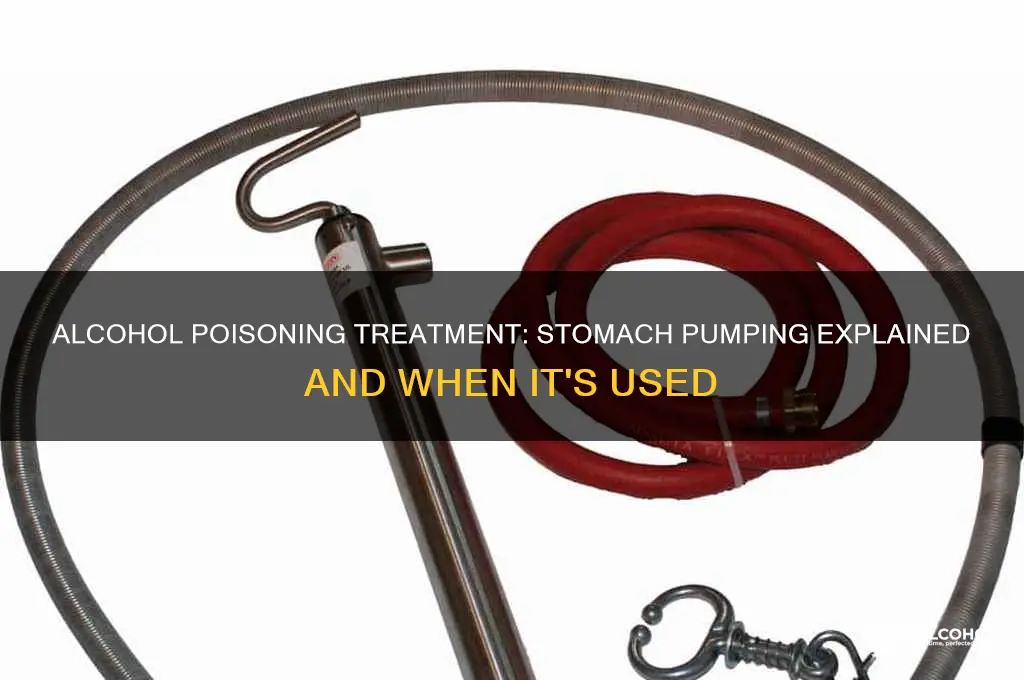 Alcohol Poisoning Treatment: Stomach Pumping Explained And When It's ...