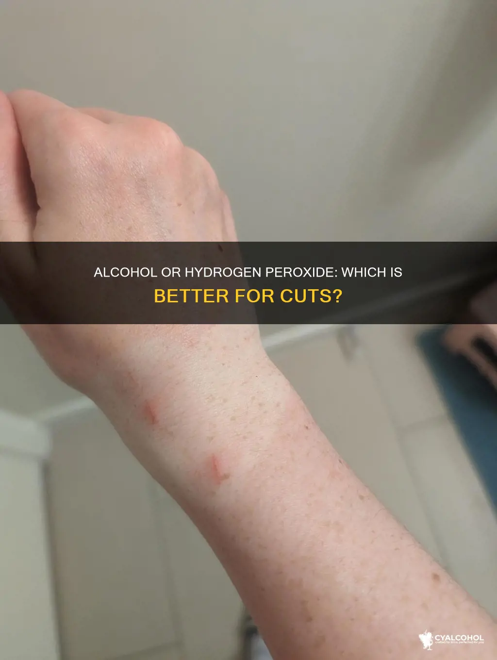 Alcohol Or Hydrogen Peroxide: Which Is Better For Cuts? | CyAlcohol