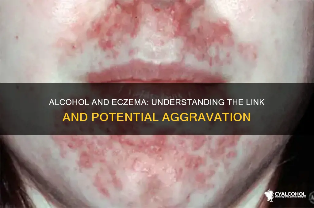Alcohol And Eczema: Understanding The Link And Potential Aggravation ...