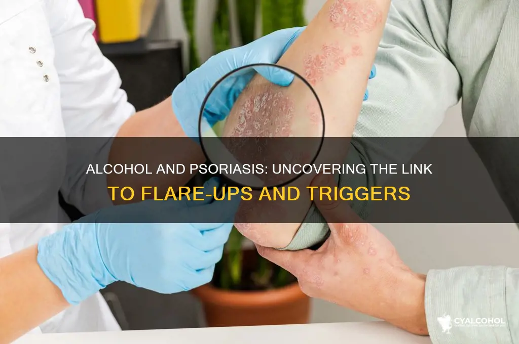 Alcohol And Psoriasis: Uncovering The Link To Flare-Ups And Triggers ...