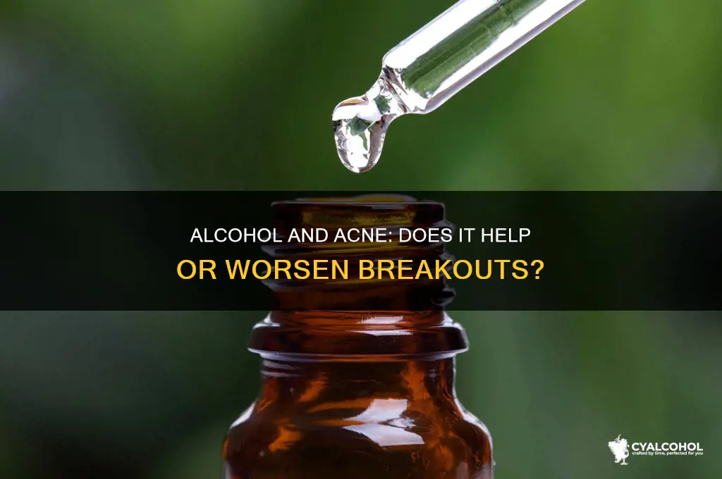 Alcohol And Acne: Does It Help Or Worsen Breakouts? | CyAlcohol