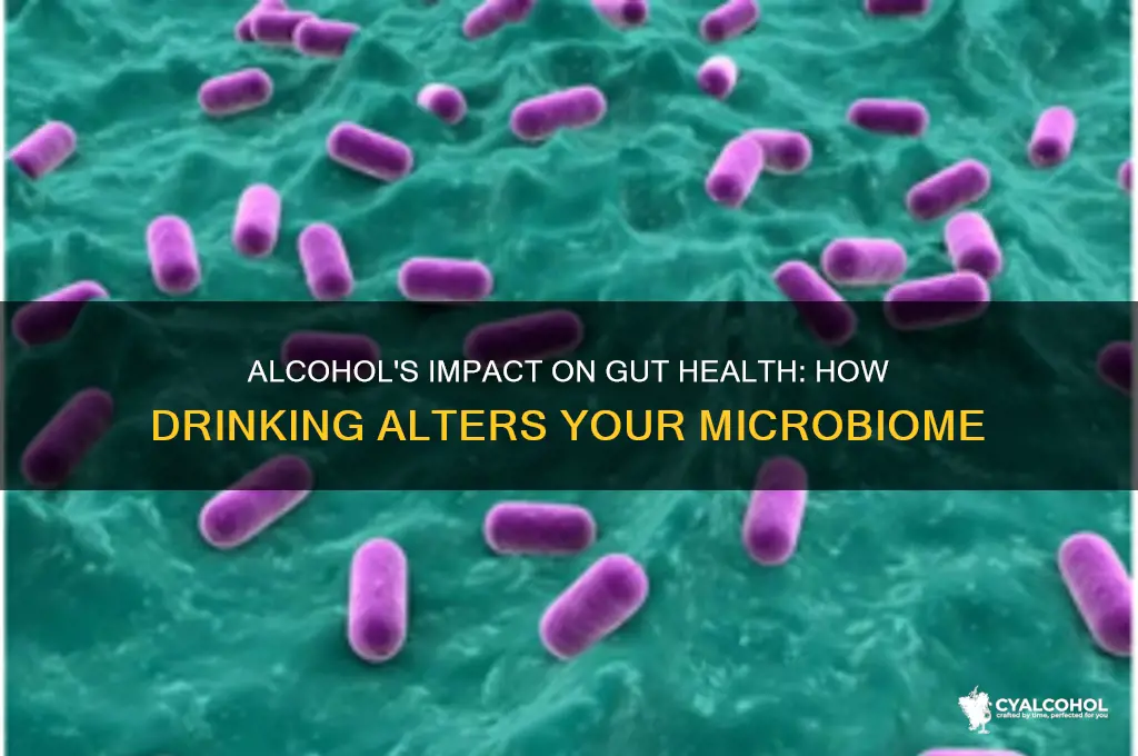 Alcohol's Impact On Gut Health: How Drinking Alters Your Microbiome ...