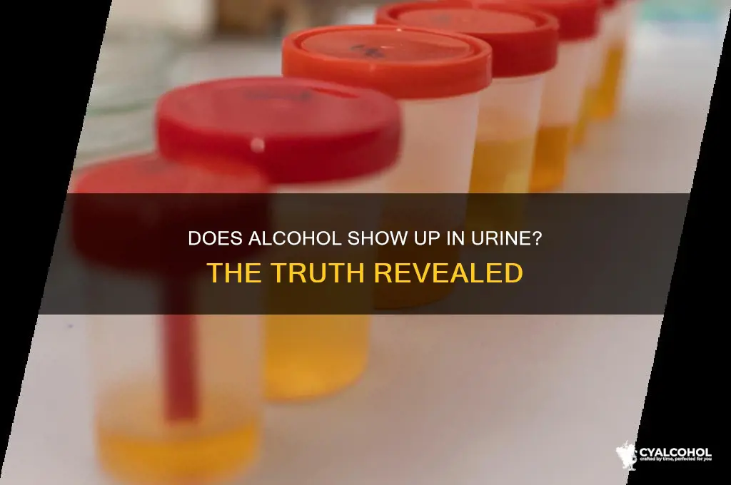 Does Alcohol Show Up In Urine? The Truth Revealed | CyAlcohol