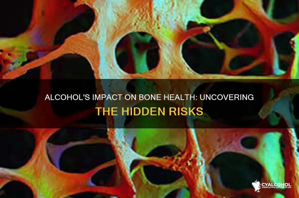 Alcohol's Impact On Bone Health: Uncovering The Hidden Risks | CyAlcohol