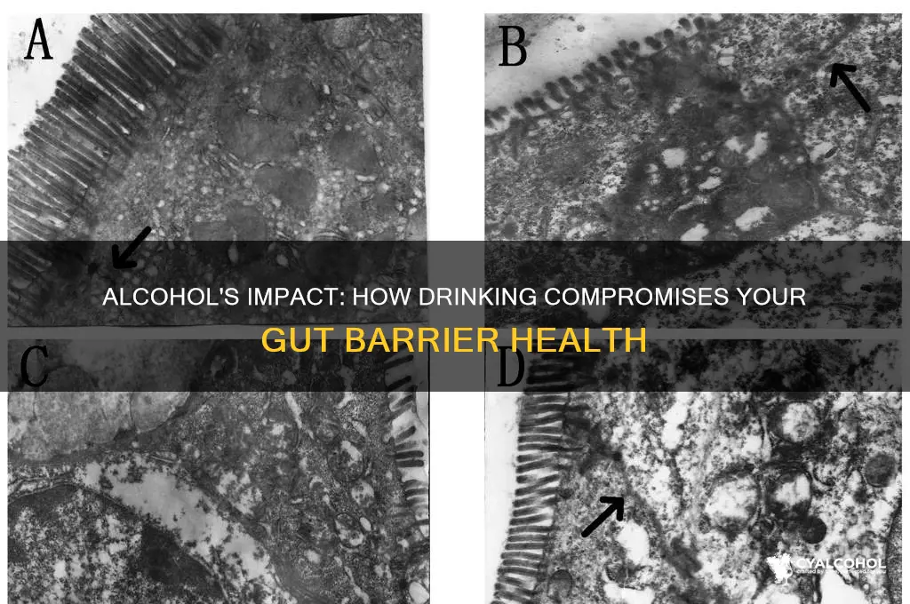 Alcohol's Impact: How Drinking Compromises Your Gut Barrier Health ...