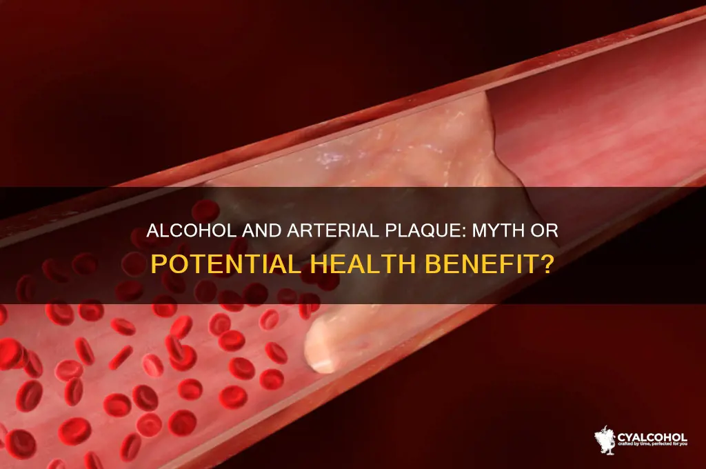 Alcohol And Arterial Plaque: Myth Or Potential Health Benefit? | CyAlcohol
