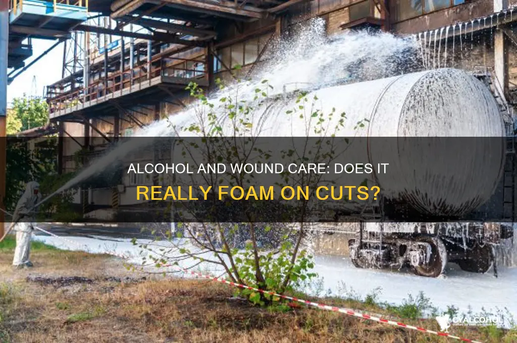 Alcohol And Wound Care: Does It Really Foam On Cuts? | CyAlcohol