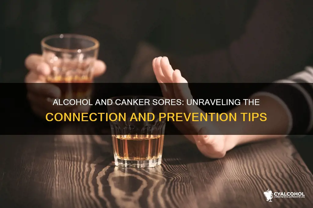 Alcohol And Canker Sores: Unraveling The Connection And Prevention Tips ...