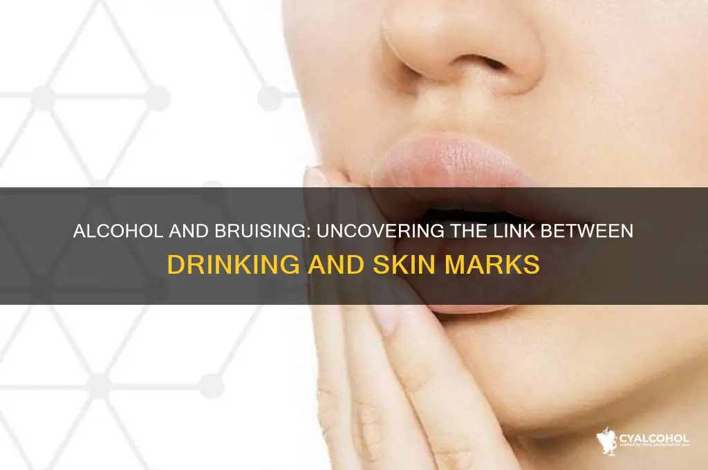 Alcohol And Bruising: Uncovering The Link Between Drinking And Skin ...