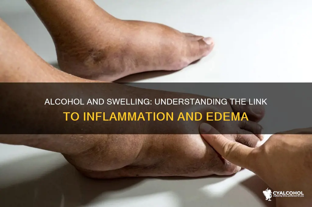 Alcohol And Swelling: Understanding The Link To Inflammation And Edema ...