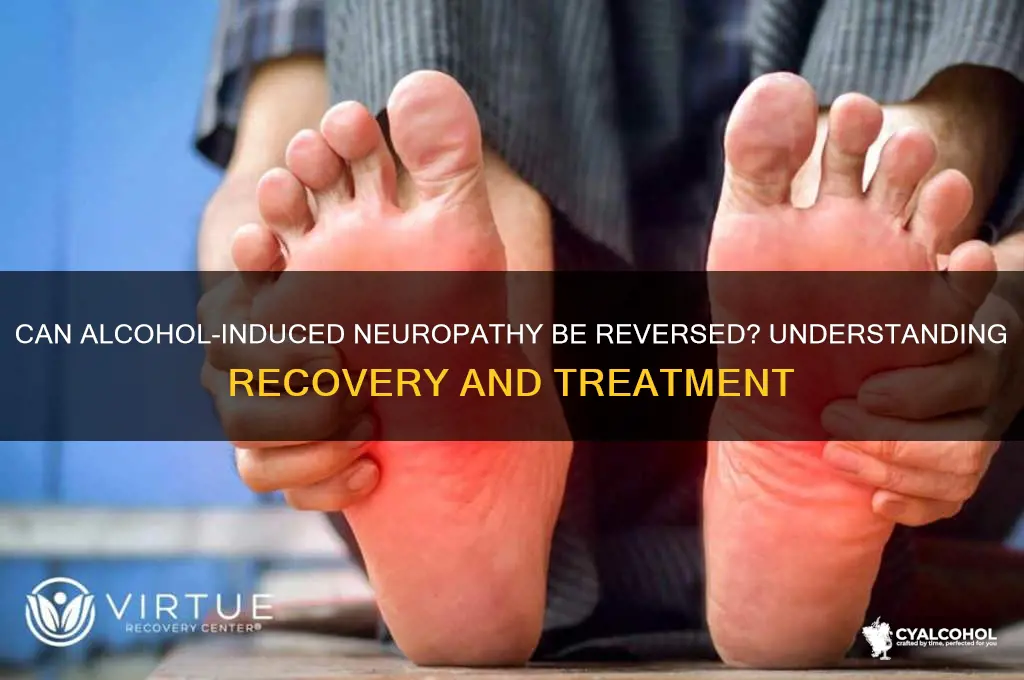 Can Alcohol-Induced Neuropathy Be Reversed? Understanding Recovery And ...