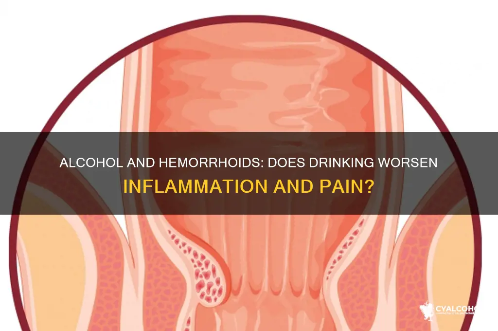 Alcohol And Hemorrhoids: Does Drinking Worsen Inflammation And Pain ...