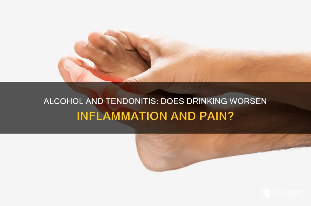 Alcohol And Tendonitis: Does Drinking Worsen Inflammation And Pain ...