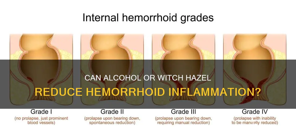 Can Alcohol Or Witch Hazel Reduce Hemorrhoid Inflammation? | CyAlcohol