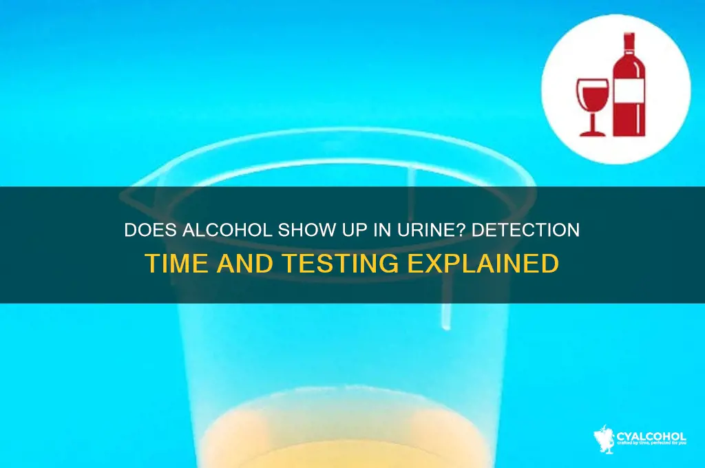 Does Alcohol Show Up In Urine? Detection Time And Testing Explained ...