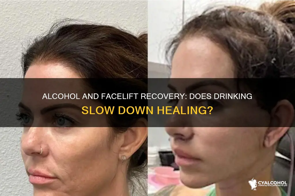 Alcohol And Facelift Recovery: Does Drinking Slow Down Healing? | CyAlcohol