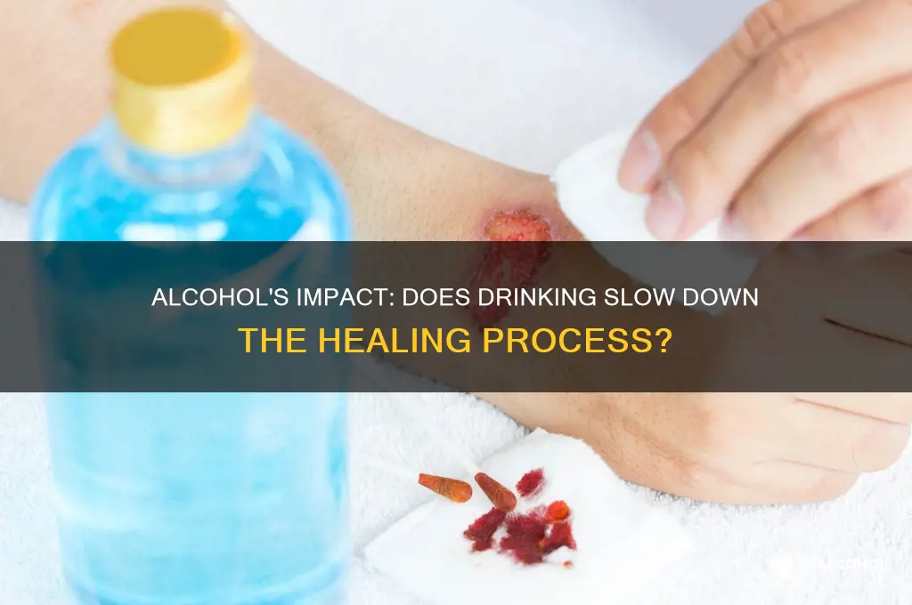 Alcohol's Impact: Does Drinking Slow Down The Healing Process? | CyAlcohol