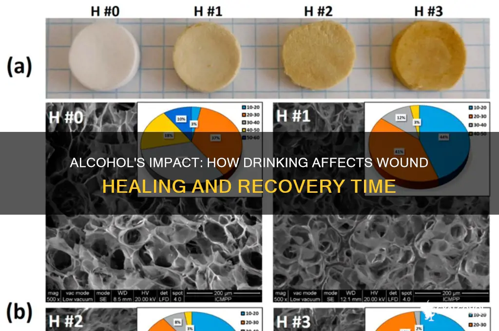Alcohol's Impact: How Drinking Affects Wound Healing And Recovery Time ...