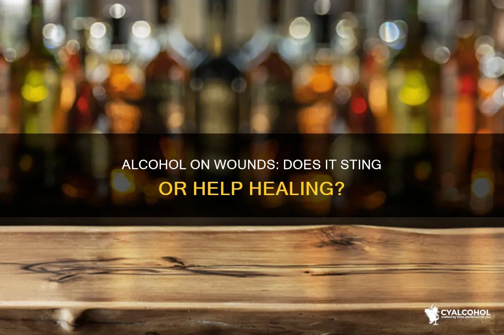 Alcohol On Wounds: Does It Sting Or Help Healing? | CyAlcohol