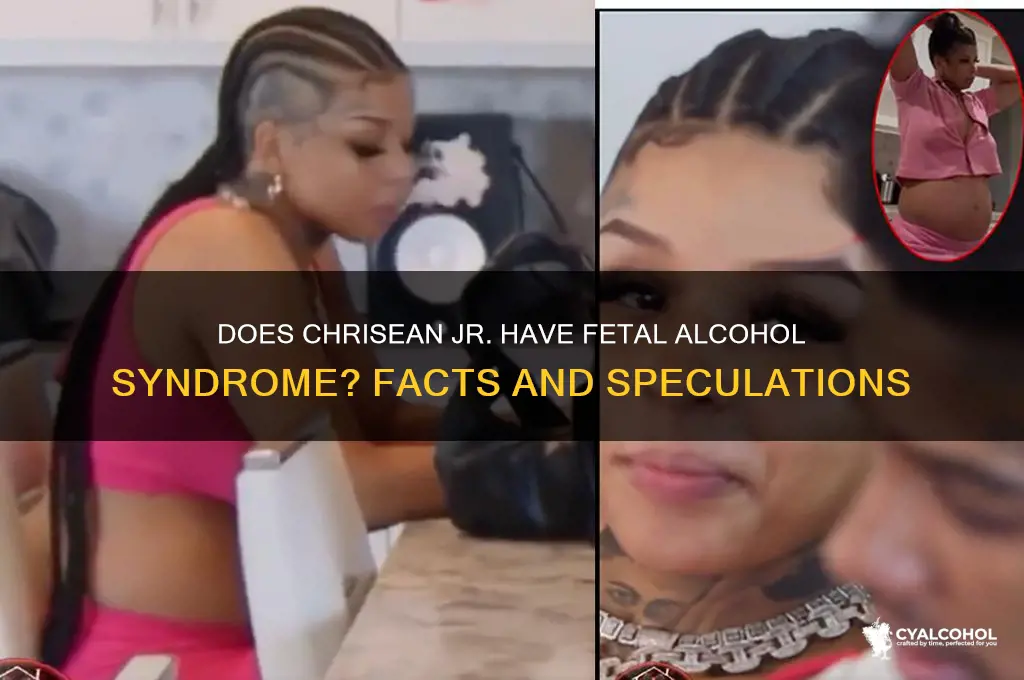 Does Chrisean Jr. Have Fetal Alcohol Syndrome? Facts And Speculations ...
