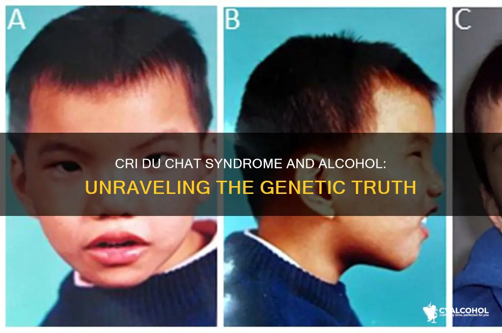 Cri Du Chat Syndrome And Alcohol: Unraveling The Genetic Truth | CyAlcohol