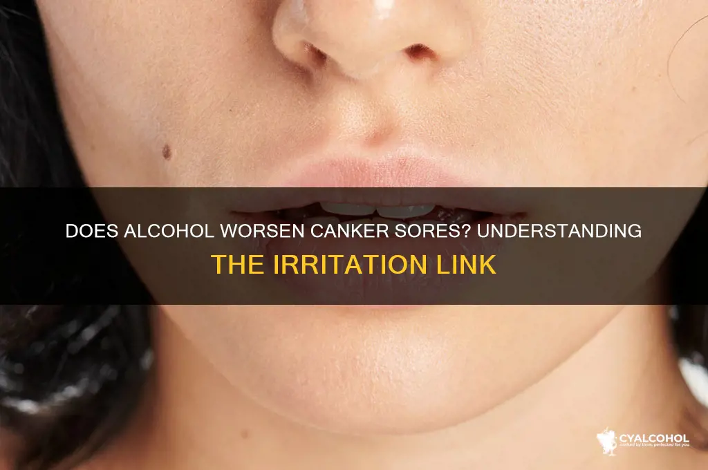 Does Alcohol Worsen Canker Sores? Understanding The Irritation Link ...