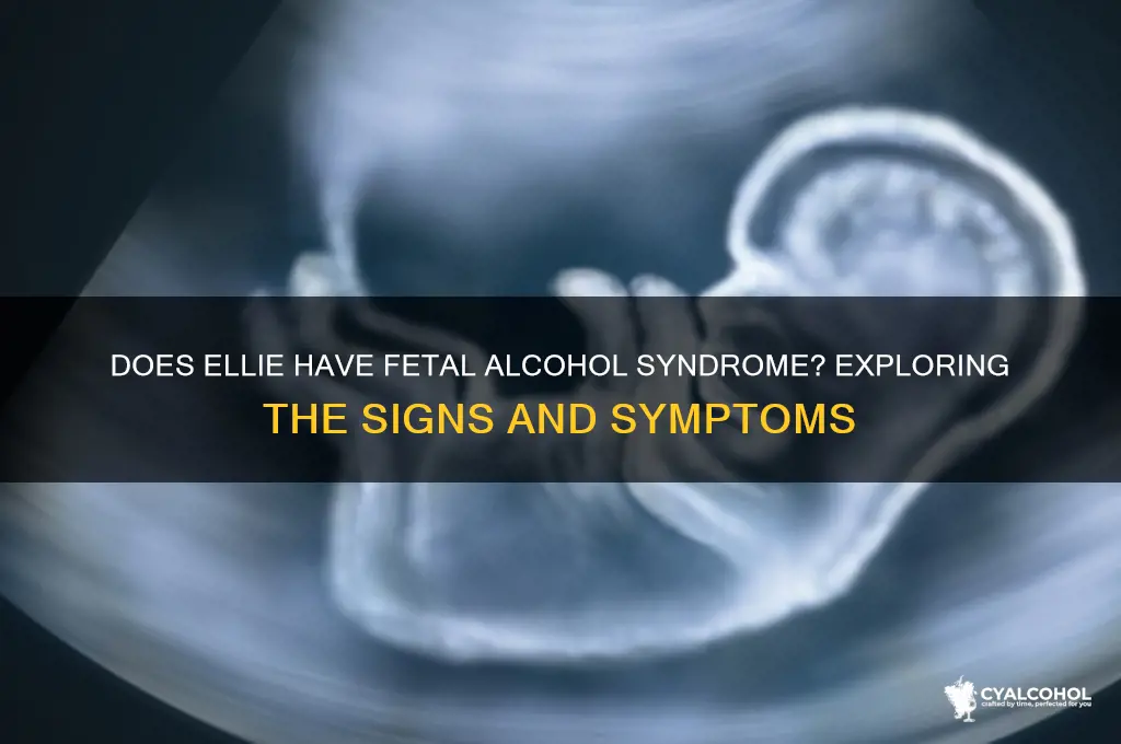 Does Ellie Have Fetal Alcohol Syndrome? Exploring The Signs And ...