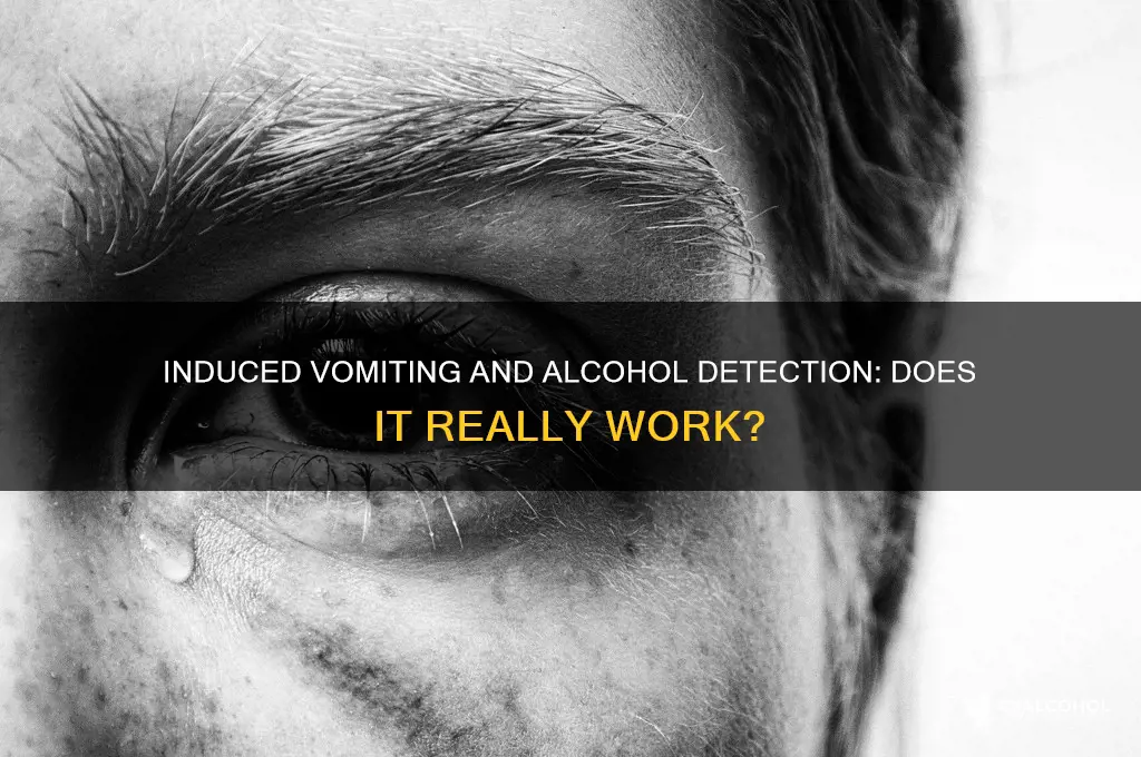 Induced Vomiting And Alcohol Detection: Does It Really Work? | CyAlcohol