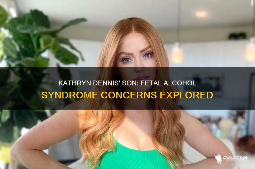 Kathryn Dennis' Son: Fetal Alcohol Syndrome Concerns Explored | CyAlcohol