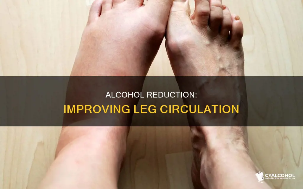 Alcohol Reduction: Improving Leg Circulation | CyAlcohol