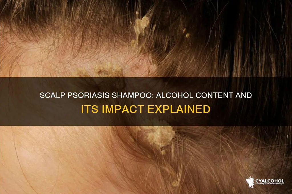 Scalp Psoriasis Shampoo: Alcohol Content And Its Impact Explained ...