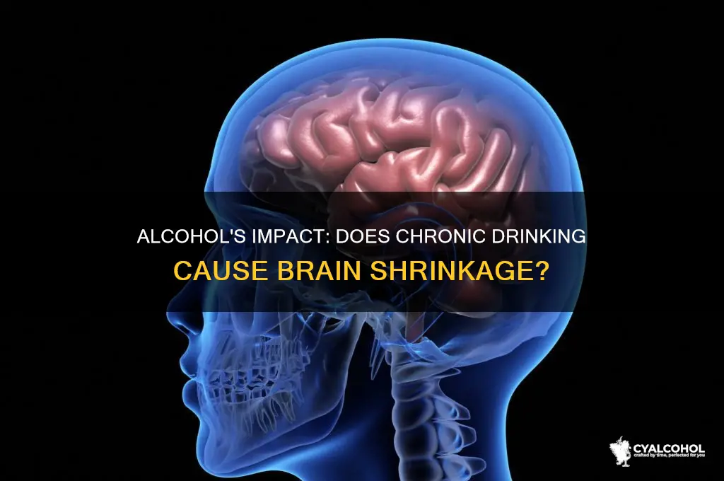 Alcohol's Impact: Does Chronic Drinking Cause Brain Shrinkage? | CyAlcohol