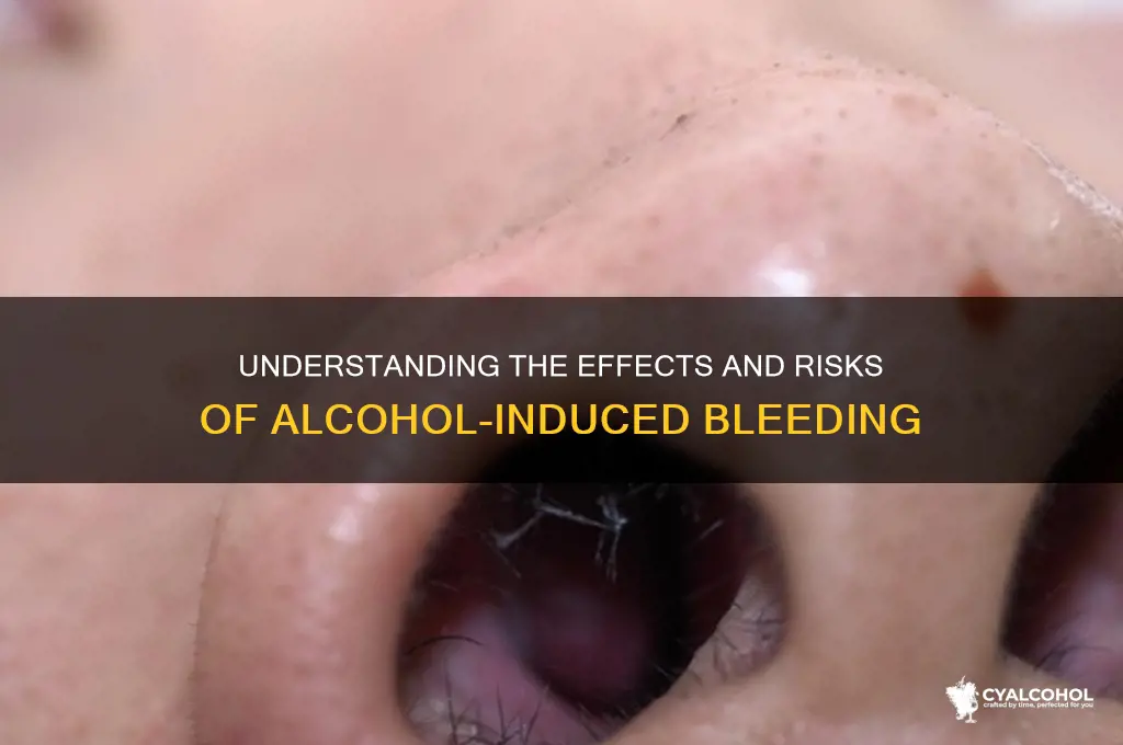Understanding The Effects And Risks Of Alcohol-Induced Bleeding | CyAlcohol