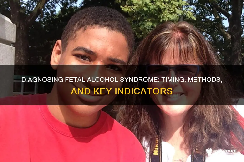 Diagnosing Fetal Alcohol Syndrome: Timing, Methods, And Key Indicators ...