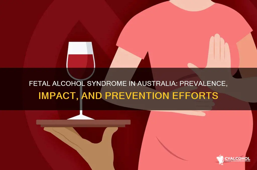 Fetal Alcohol Syndrome In Australia: Prevalence, Impact, And Prevention ...