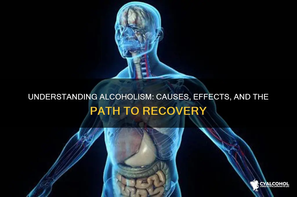 Understanding Alcoholism: Causes, Effects, And The Path To Recovery ...