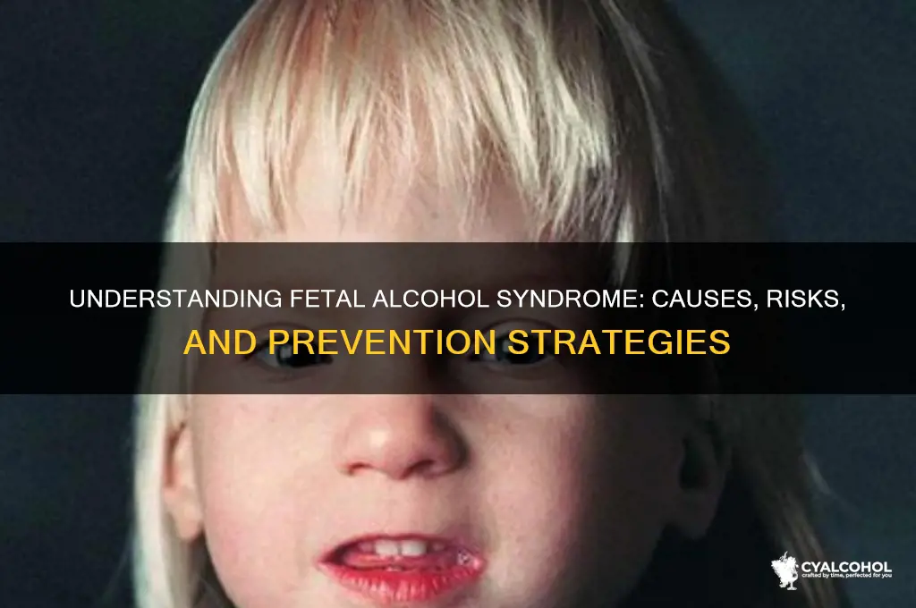 Understanding Fetal Alcohol Syndrome: Causes, Risks, And Prevention ...