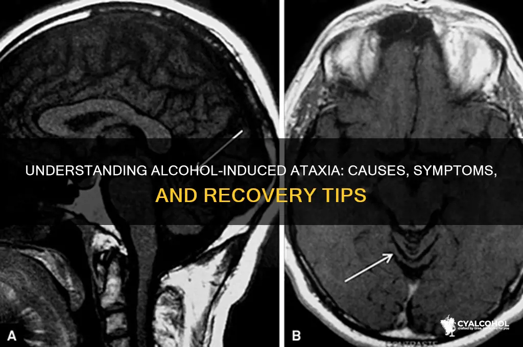 Understanding Alcohol-Induced Ataxia: Causes, Symptoms, And Recovery ...