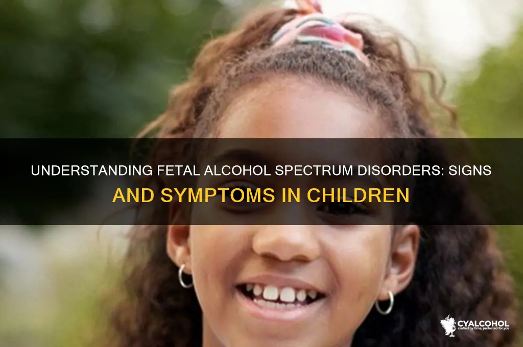 Understanding Fetal Alcohol Spectrum Disorders: Signs And Symptoms In ...