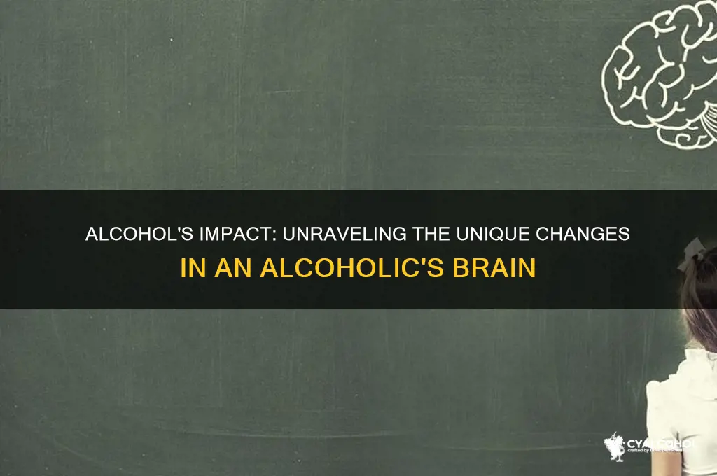 Alcohol's Impact: Unraveling The Unique Changes In An Alcoholic's Brain ...