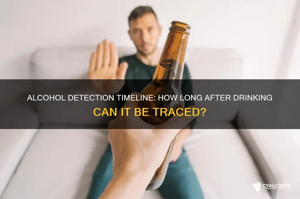 Alcohol Detection Timeline: How Long After Drinking Can It Be Traced ...