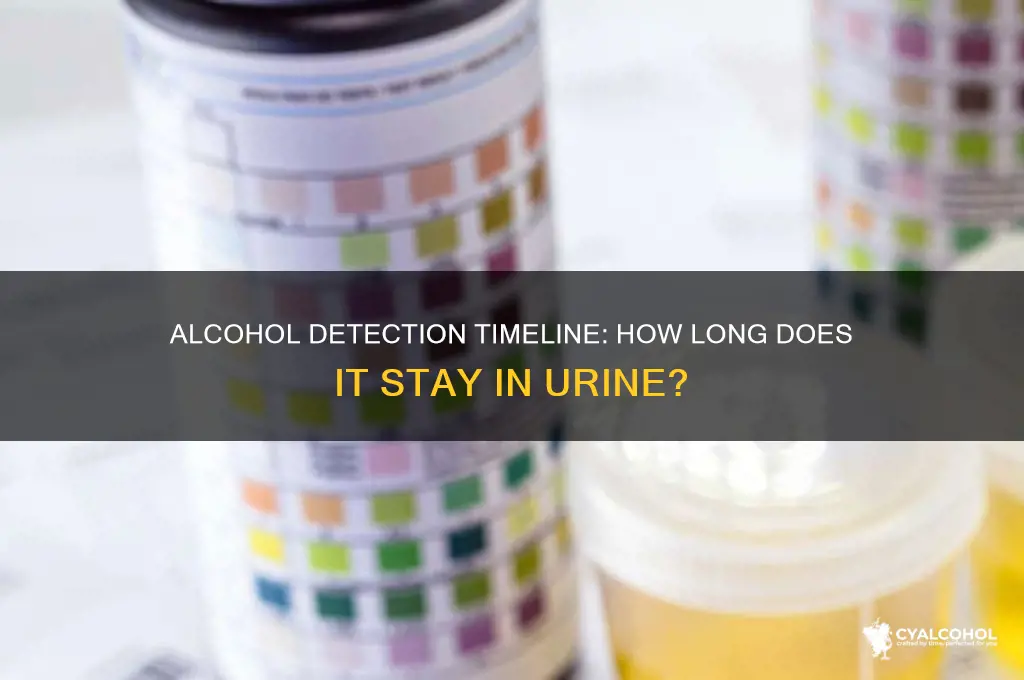 Alcohol Detection Timeline: How Long Does It Stay In Urine? | CyAlcohol