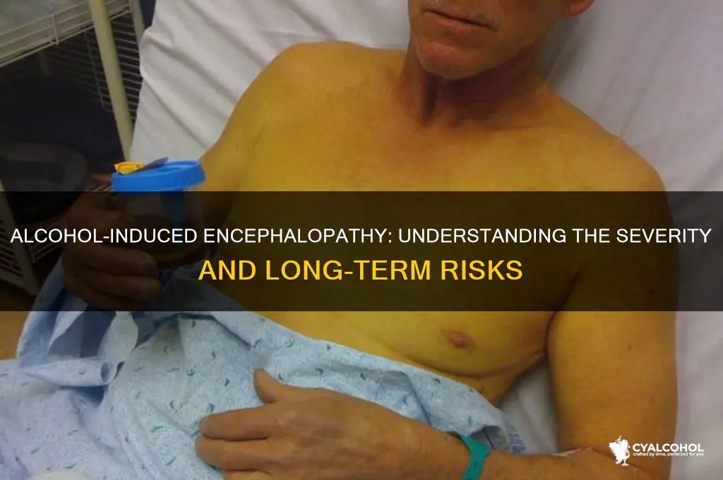 Alcohol-Induced Encephalopathy: Understanding The Severity And Long ...
